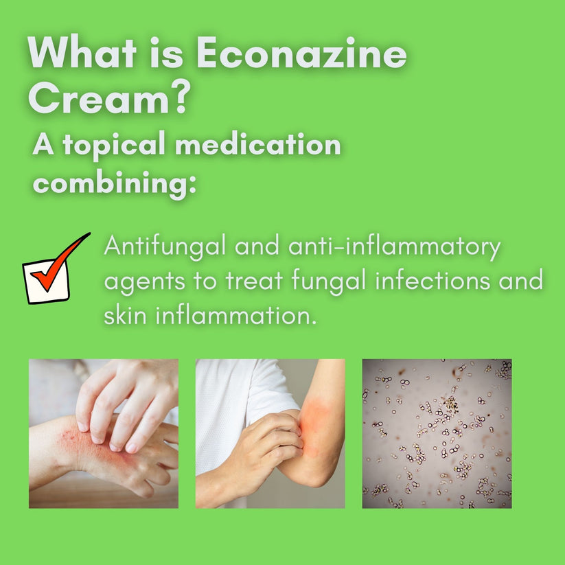 Econazine Cream 10g Antifungal & Anti-Inflammaory/Ubat anti gatal. Exp ...