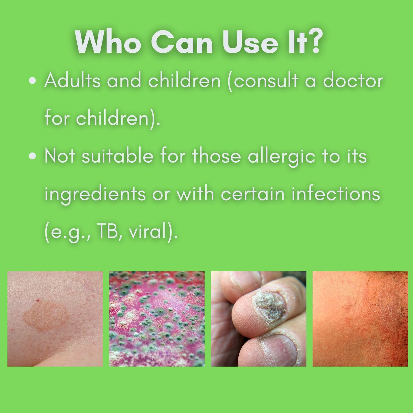 [READY STOCK] Econazine Cream 10g (Antifungal & Anti-Inflammaory/Ubat ...